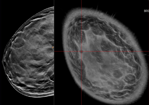QT Ultrasound – Case 1B - multiple cysts (002L) - QT Ultrasound